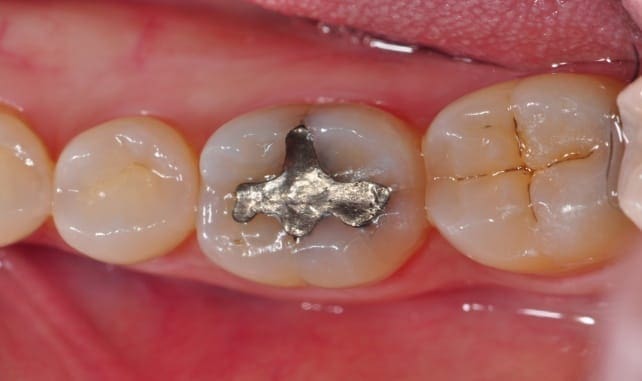 Pediatric Dentistry | Ottawa Downtown Dentist